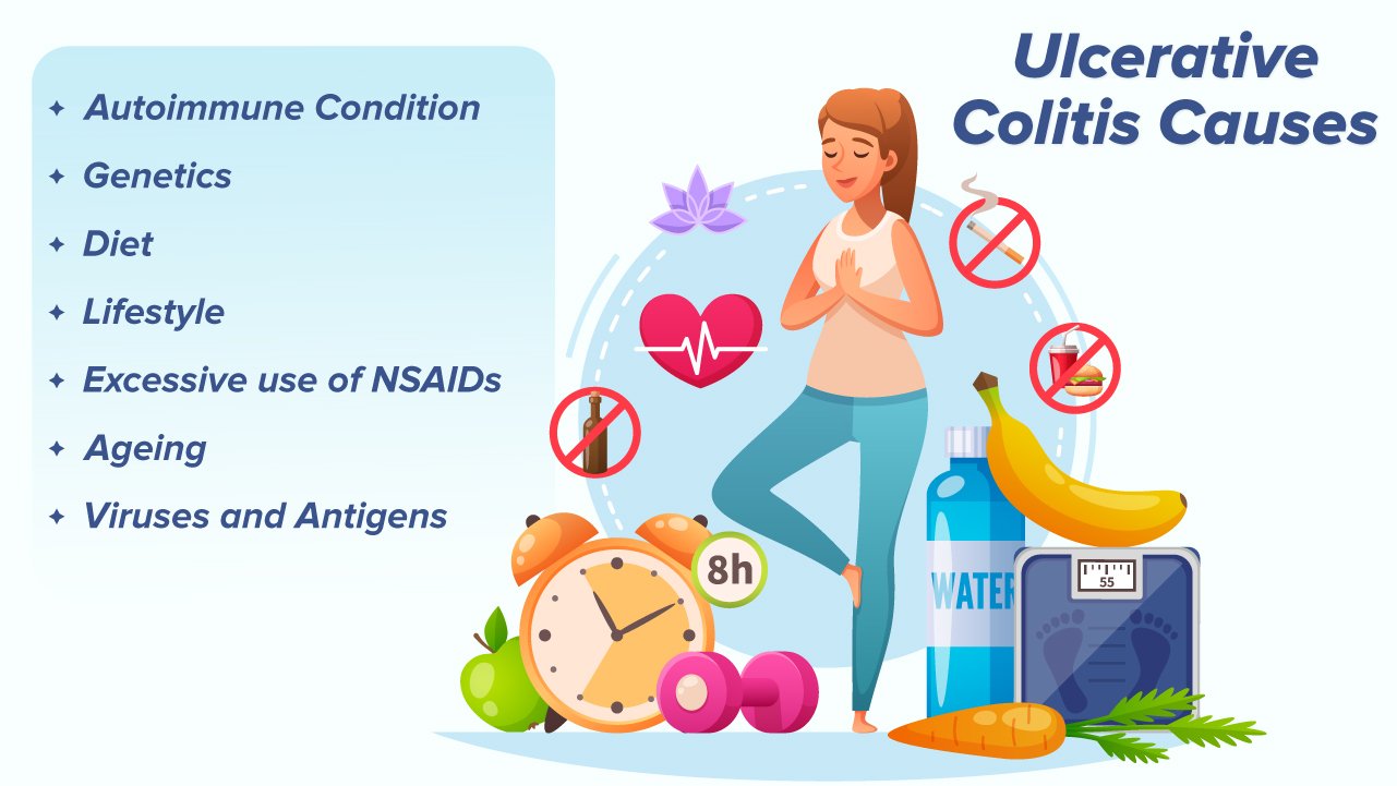Ulcerative Colitis – रक्तातिसार: 7 Powerful Symptoms & Effective ...